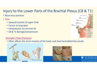 Lecture 5.1 Axilla and Brachial Plexus Moodle version.pdf