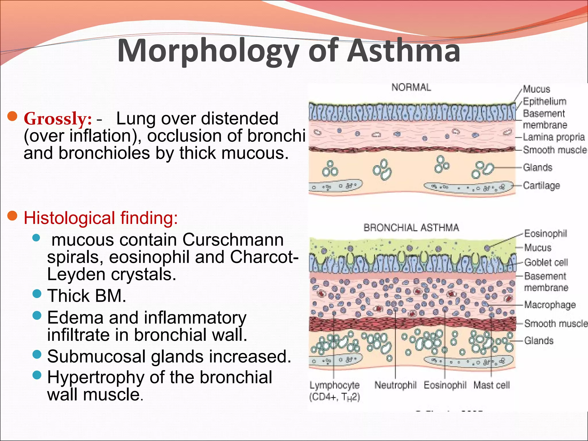Lecture 5 asthma and copd | PPT