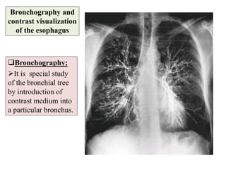 lecture 5 - X-ray chest.ppt