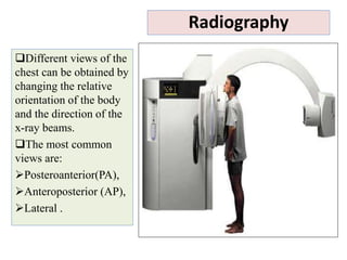 lecture 5 - X-ray chest.ppt