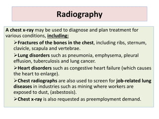 lecture 5 - X-ray chest.ppt