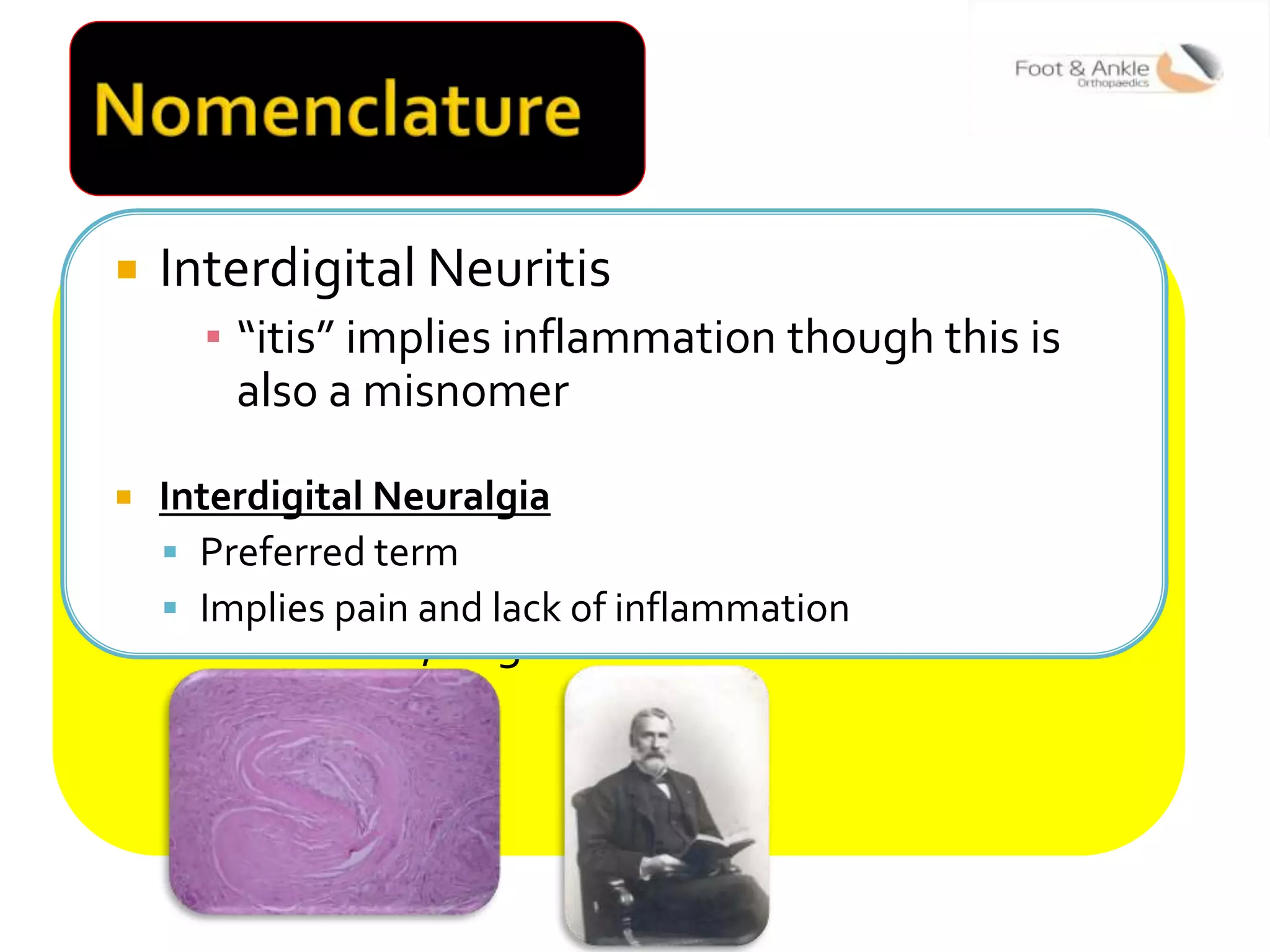 Lecture 50 shah morton neuroma | PPTX