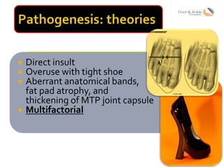 Lecture 50 shah morton neuroma | PPTX