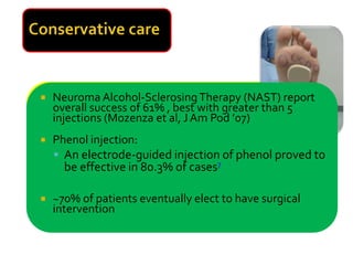 Lecture 50 shah morton neuroma | PPTX