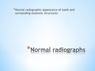 Lecture 5 a_radiographic_presentation_2012 | PPT | Free Download