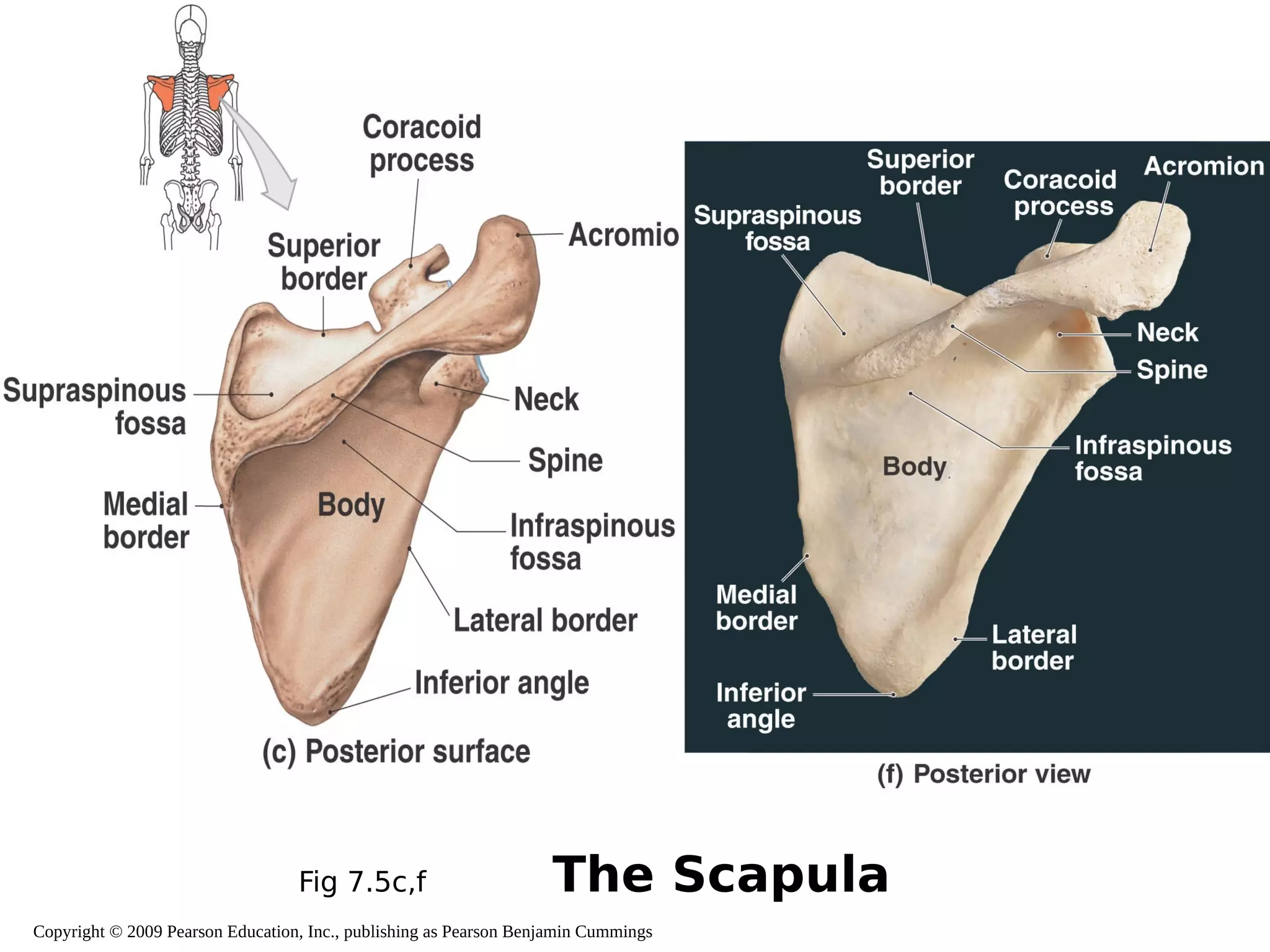 lecture 5a Scapular region Brachium.pdf
