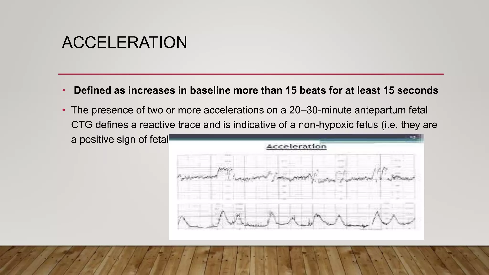 Lecture 5 Assessment of fetal wellbeing | PPTX