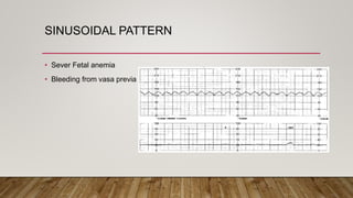 Lecture 5 Assessment of fetal wellbeing | PPTX