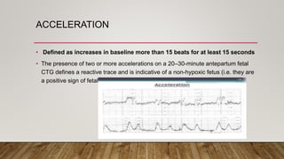 Lecture 5 Assessment of fetal wellbeing | PPTX