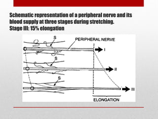 Lecture 5 BIOMECHANICS OF PERIPHERAL NERVE AND SPINAL NERVE ROOTS.ppt