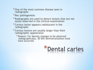 Lecture 5 b_radiographic_interpretation_dental_caries_2012 | PPT