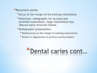 Lecture 5 b_radiographic_interpretation_dental_caries_2012 | PPT