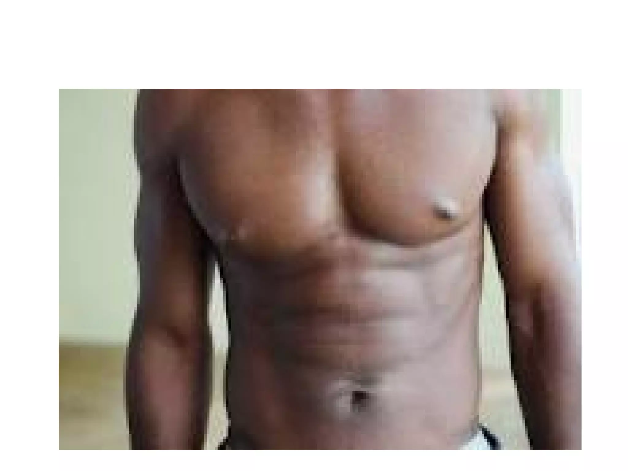 lecture 5b The breast and pectoral region.pdf