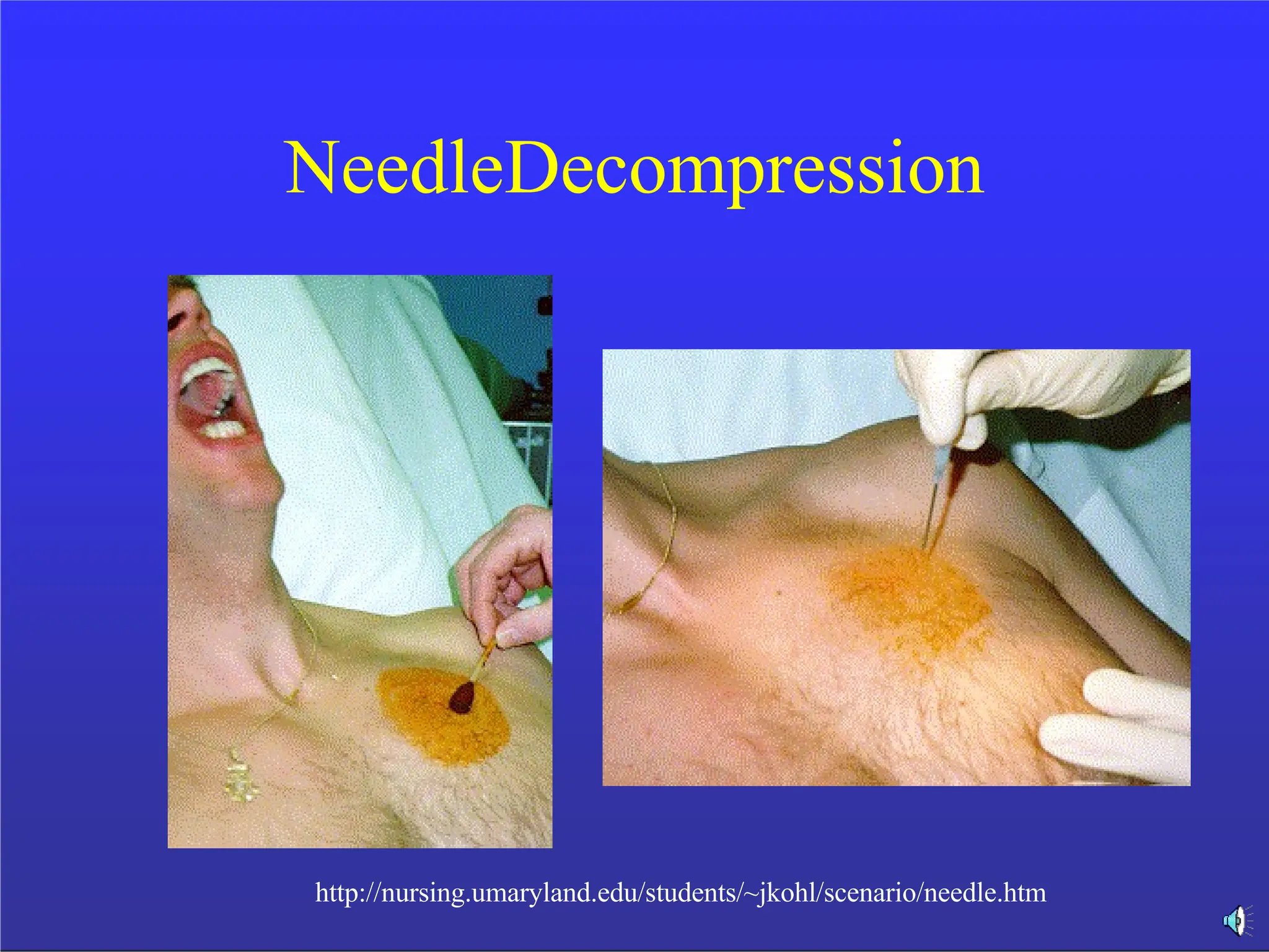 lecture_5_chest_trauma.docx ahshsjjsjajjaja | PPT