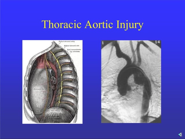 lecture_5_chest_trauma.docx ahshsjjsjajjaja | PPT