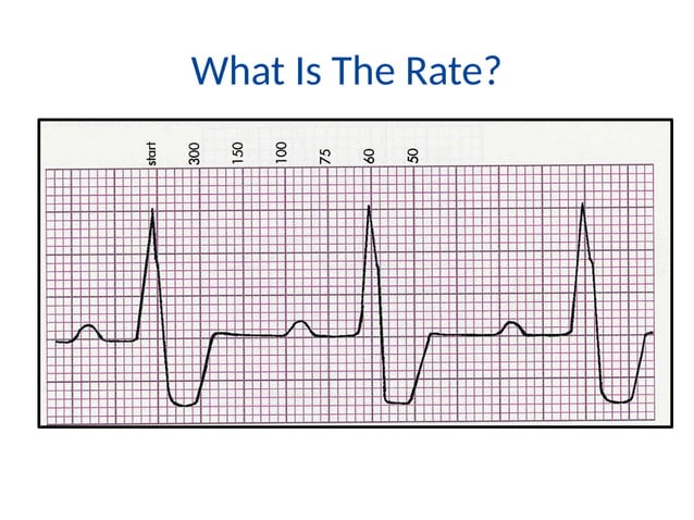 Lecture 5 Ecg lecture ECG Lecture Educational.pptx