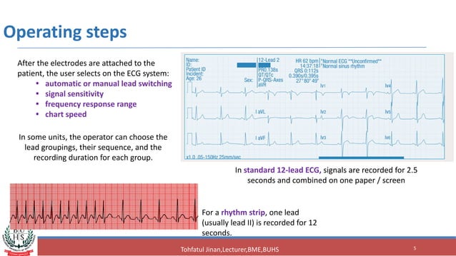ECG Recorder description types operation use | PPT