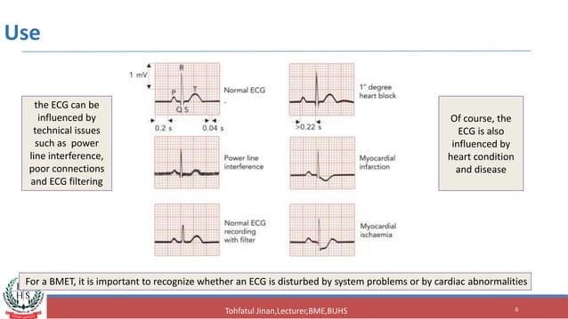 ECG Recorder description types operation use | PPT