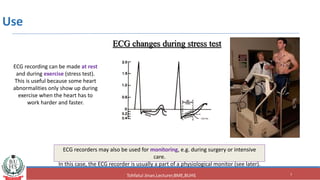 ECG Recorder description types operation use | PDF