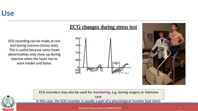 ECG Recorder description types operation use | PPT