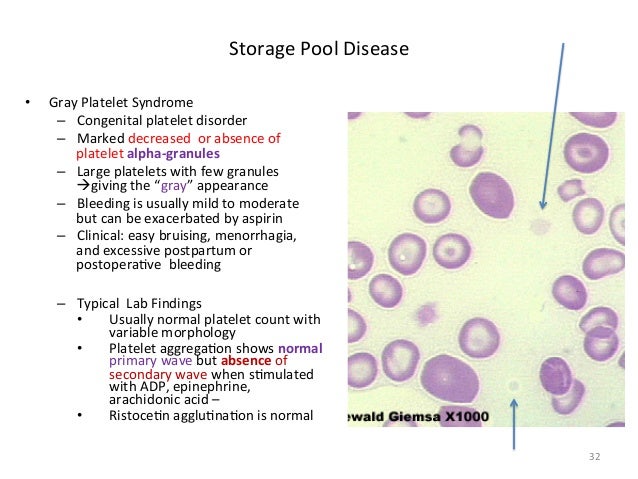 Lecture 5, fall 2014 pdf