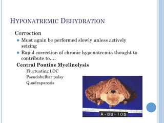 Lecture_5 Fluids.pptx