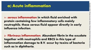 Lecture 5 inflammation | PPTX
