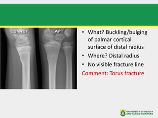 Lecture 5 Interpretation of upper limb 2.pdf