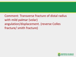 Lecture 5 Interpretation of upper limb 2.pdf