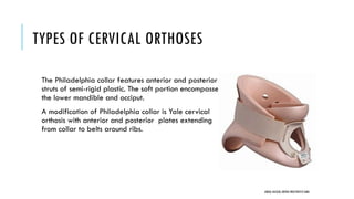 lecture#5 Spinal orthosis.pptx kmu ipmr p | PPTX