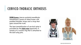 lecture#5 Spinal orthosis.pptx kmu ipmr p | PPT