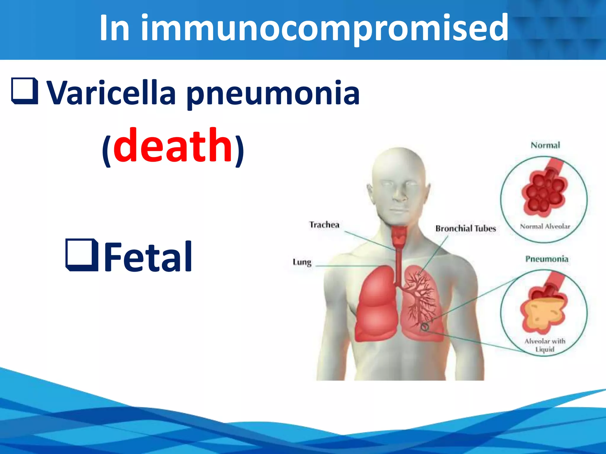 Lecture 5 Varciella-Zoster virus.pptx