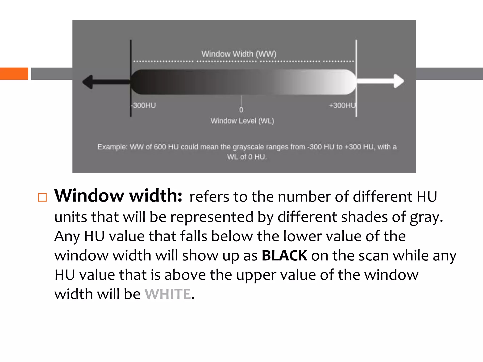 UNDERSTANDING CT SCAN windowing | PPTX