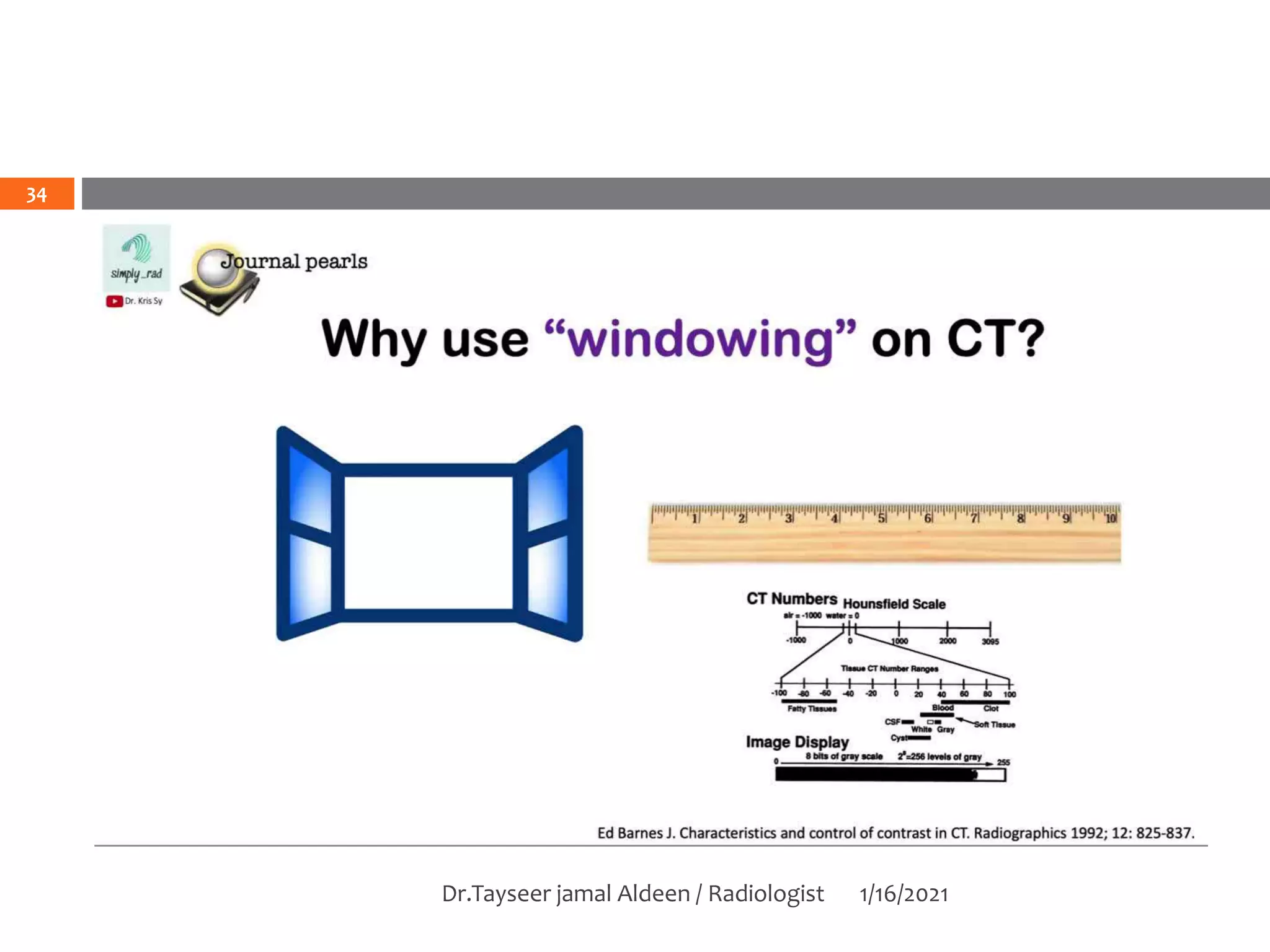 UNDERSTANDING CT SCAN windowing | PPTX
