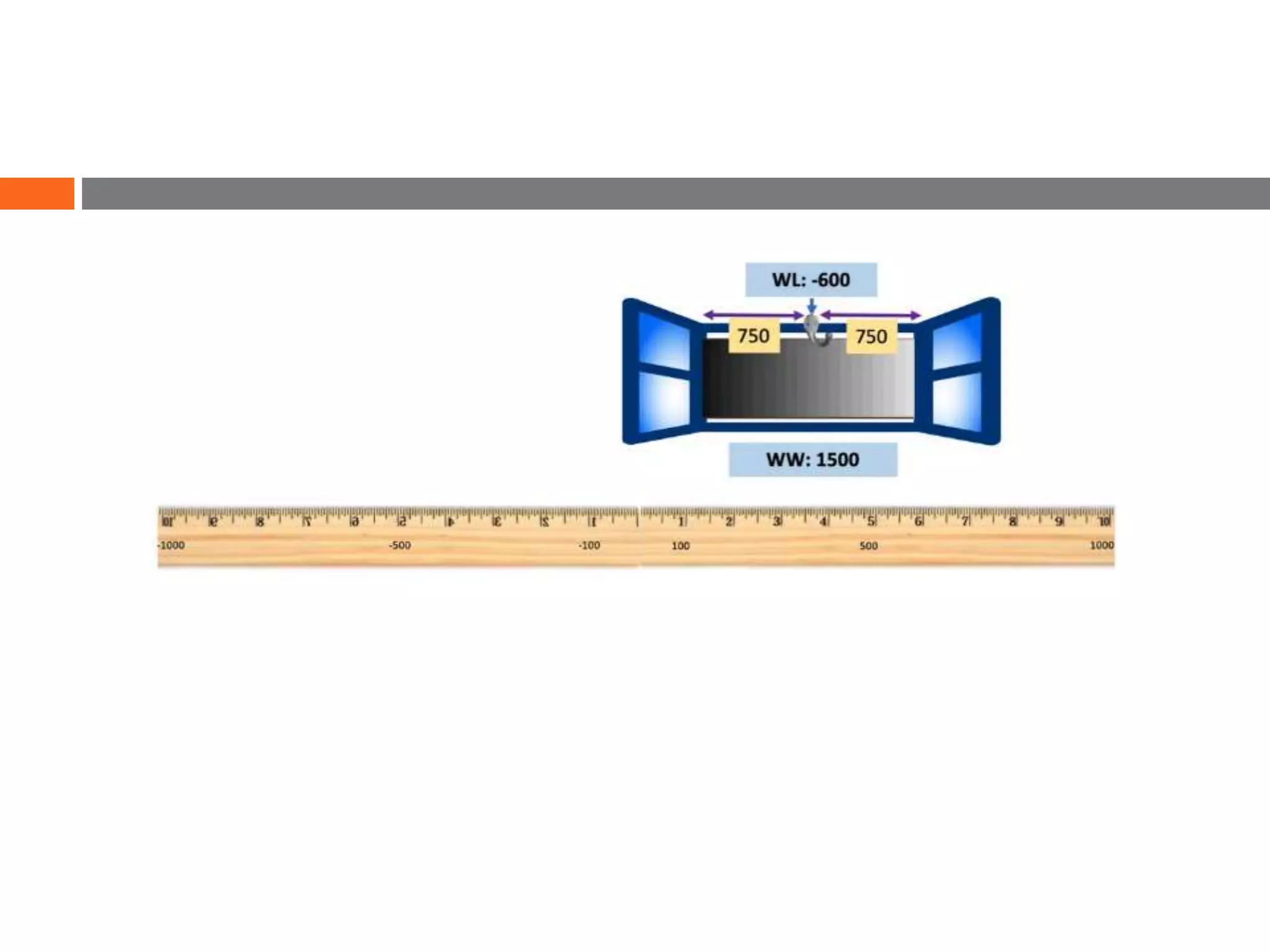 UNDERSTANDING CT SCAN windowing | PPTX
