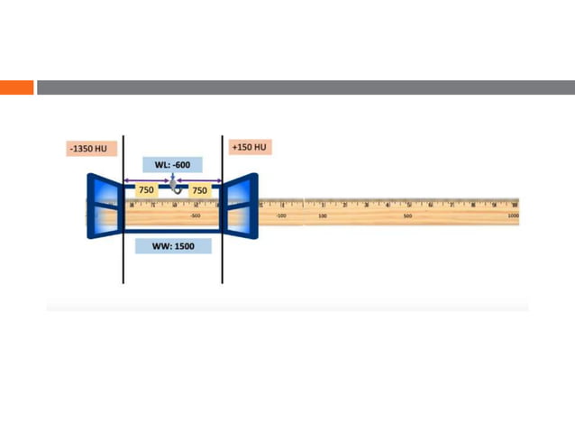 UNDERSTANDING CT SCAN windowing | PPTX