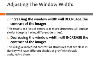 UNDERSTANDING CT SCAN windowing | PPT