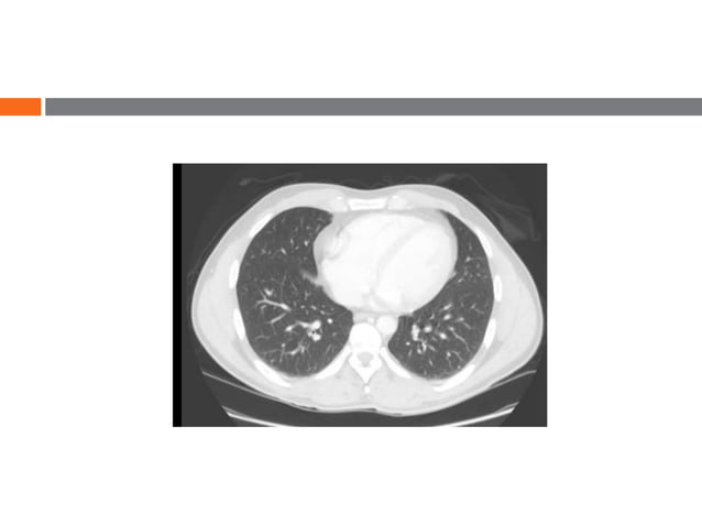 UNDERSTANDING CT SCAN windowing | PPTX