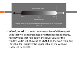 UNDERSTANDING CT SCAN windowing | PPTX | Brain and Nervous System ...