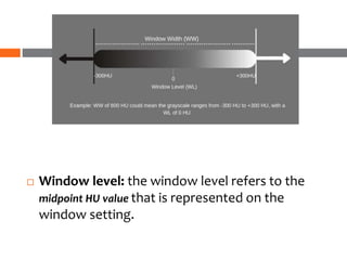 UNDERSTANDING CT SCAN windowing | PPT