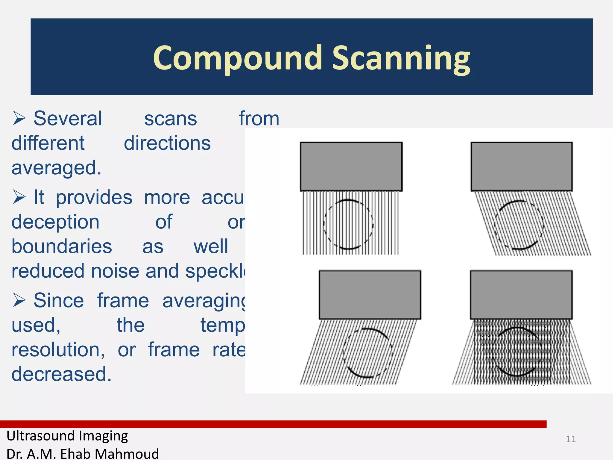 Medical Equipment Ultrasound Lecture 6 | PDF