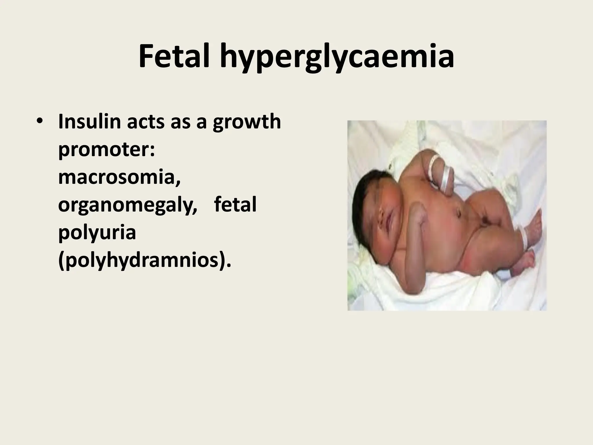 Lecture 6. Endocrine diseases and pregnancy (1).pdf