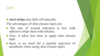 SURGICAL SUTURES | PPT