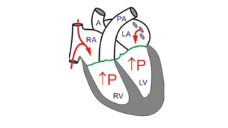 Lecture 6_Cardiac cycle. ppsx Cardiac cycle | PPT