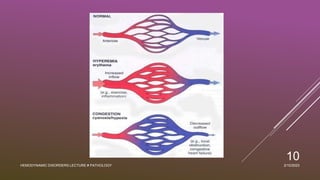 LECTURE # 6 HEMODYNAMIC DISORDERS.pptx
