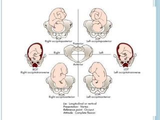 lecture_6_malpresentation, fetal position | PPT
