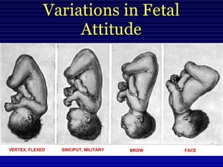 lecture_6_malpresentation, fetal position | PPT