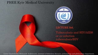 Tuberculosis and HIV/AIDS or co-infection tuberculosis/HIV | PPTX