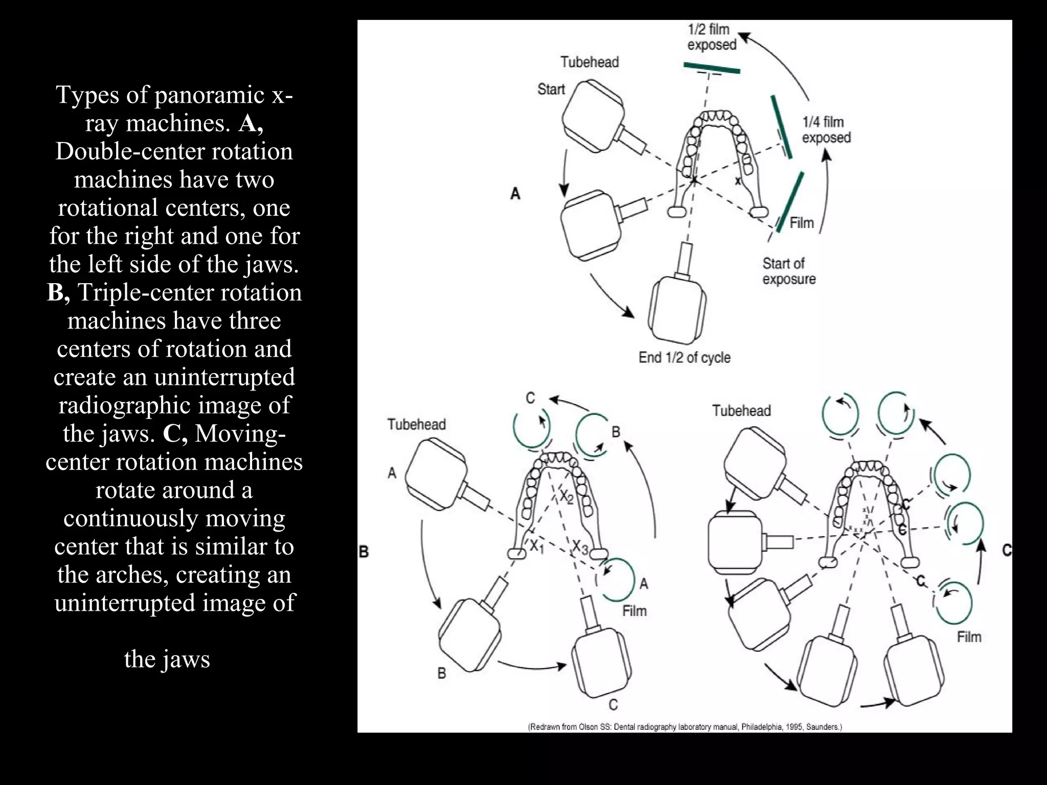 Lecture 6 panoramic radiograph | PPT