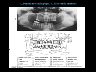 Lecture 6 panoramic radiograph | PPT